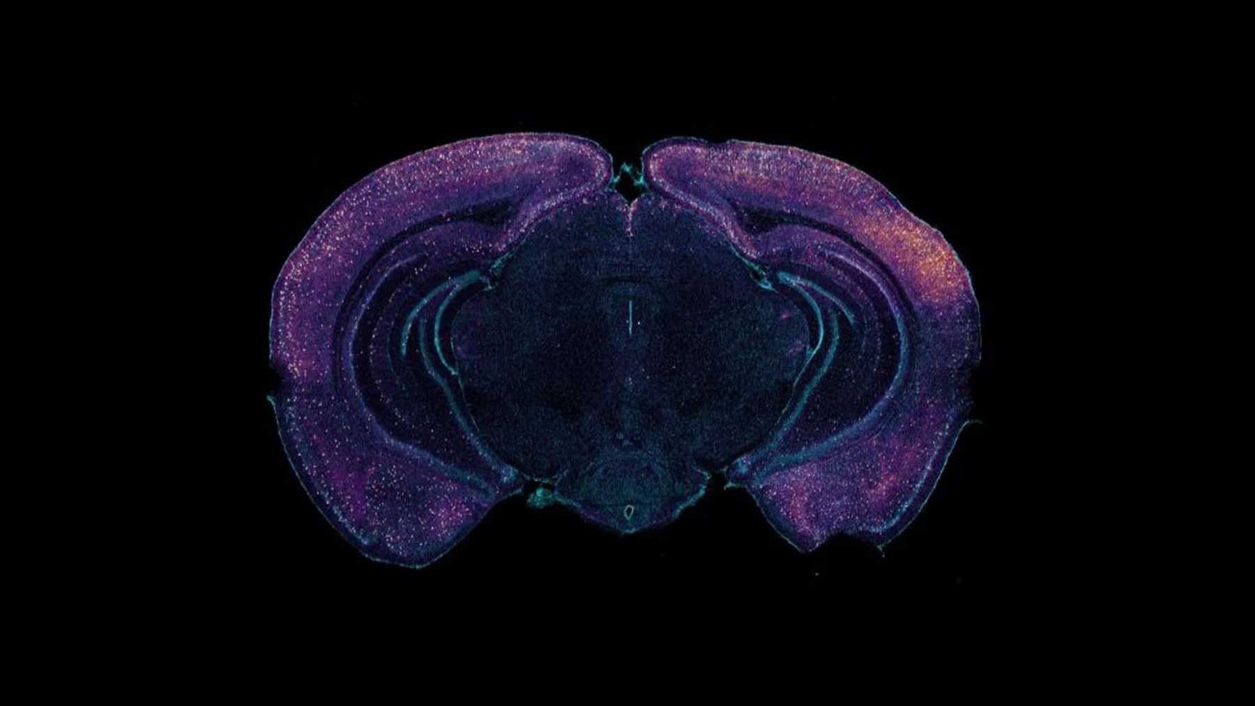 Estimulación cerebral a 40 Hz: Potencia la longevidad cerebral de forma ...